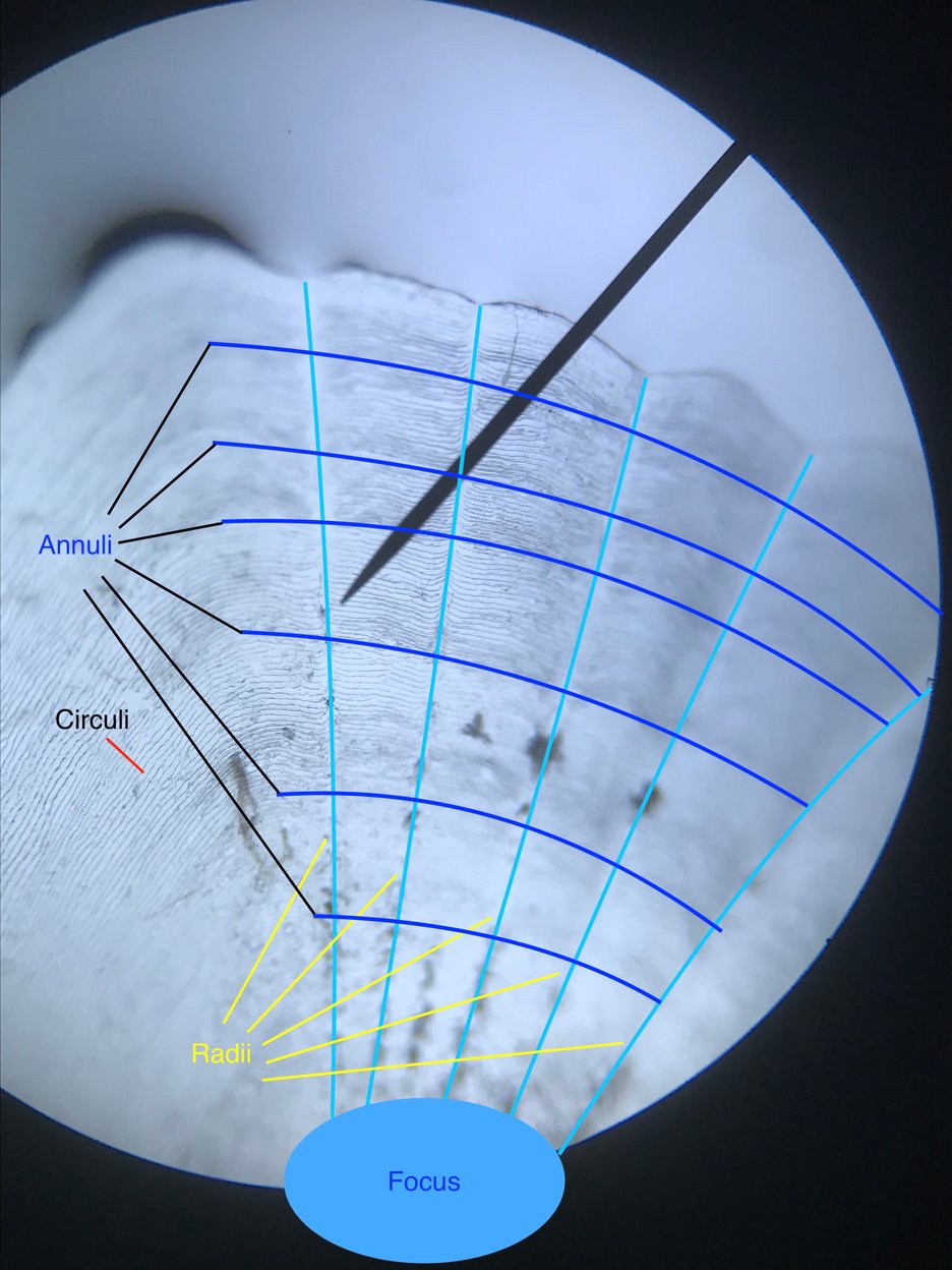 Determining the age of fish